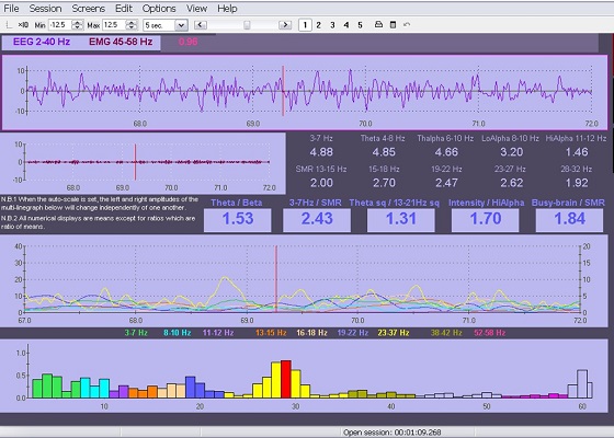 Test skærm - BrainBalance - Neurofeedback